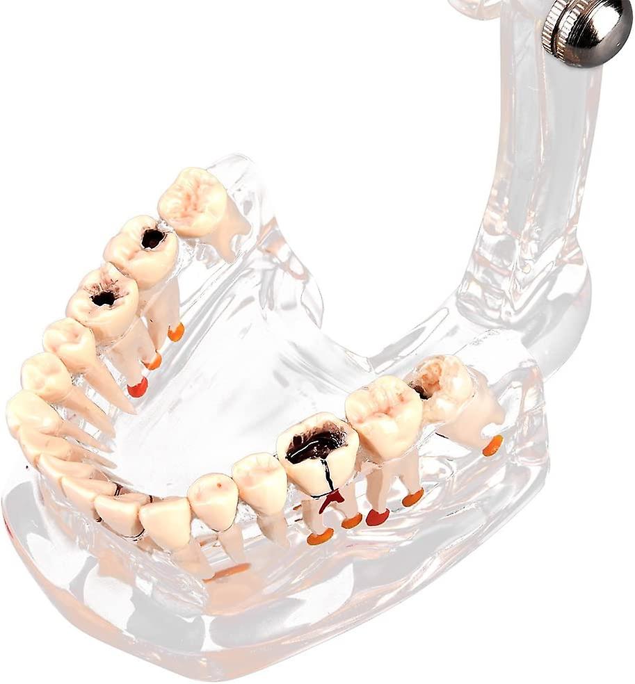 Dientes Transparentes: Explora la Odontología con Nuestro Modelo ...