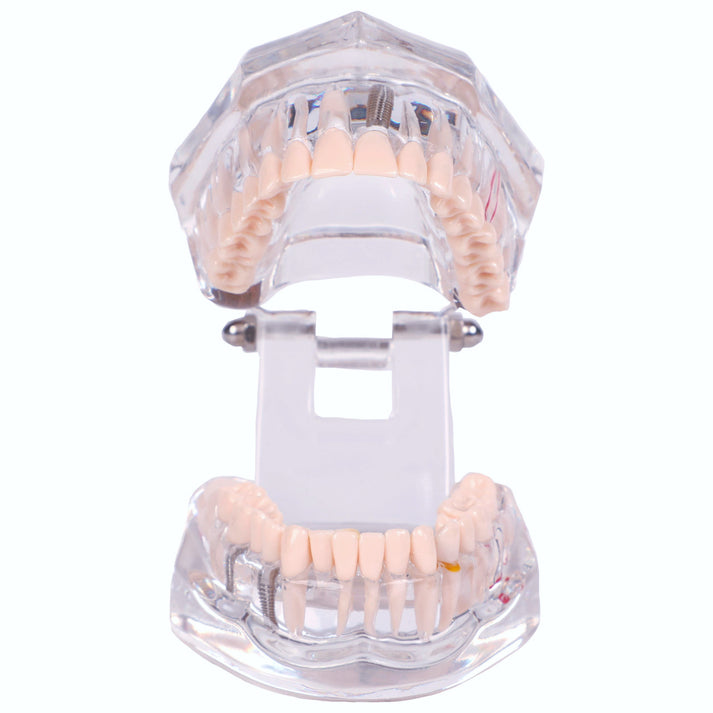 Modelo Anatómico Transparente de Dientes Permanentes – Manatomicos