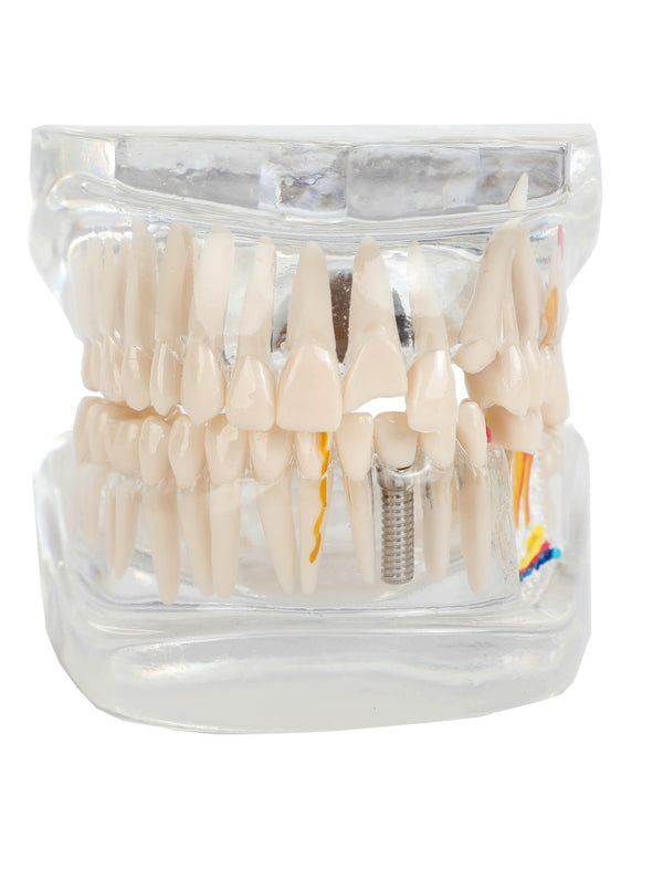 Dientes Transparentes: Modelo Anatómico con Referencia Normal y ...